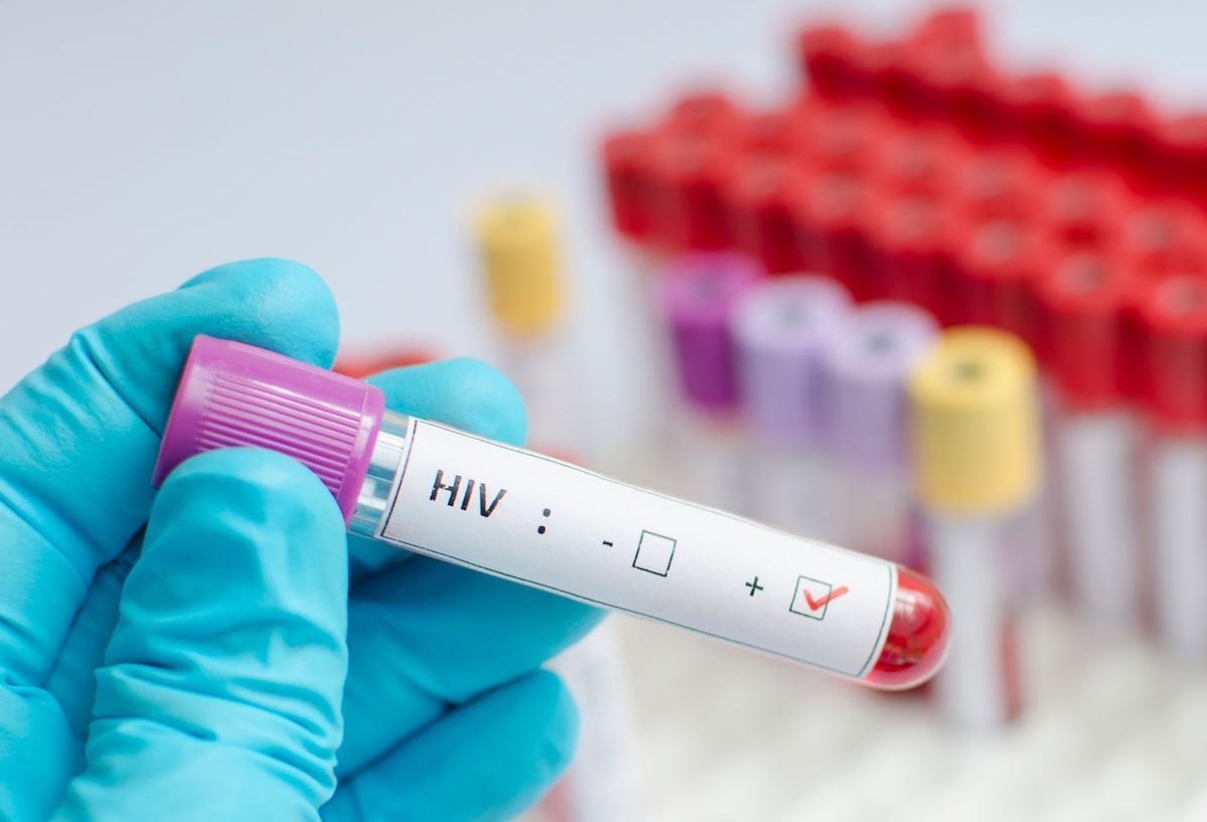 OPS aclara: VIH en República Dominicana no es nueva epidemia, aquí los ...